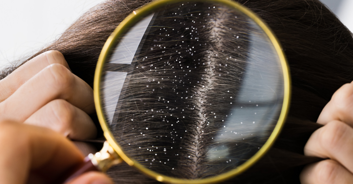 ¡Descubre los 4 IMPRESIONANTES BENEFICIOS de la MIEL en tu cabello! ‍鈴 ...